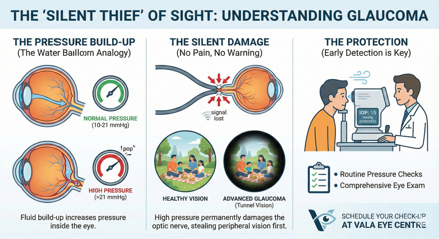 Glaucoma: The "Silent Thief" of Sight – Why Pressure Checks Matter ...
